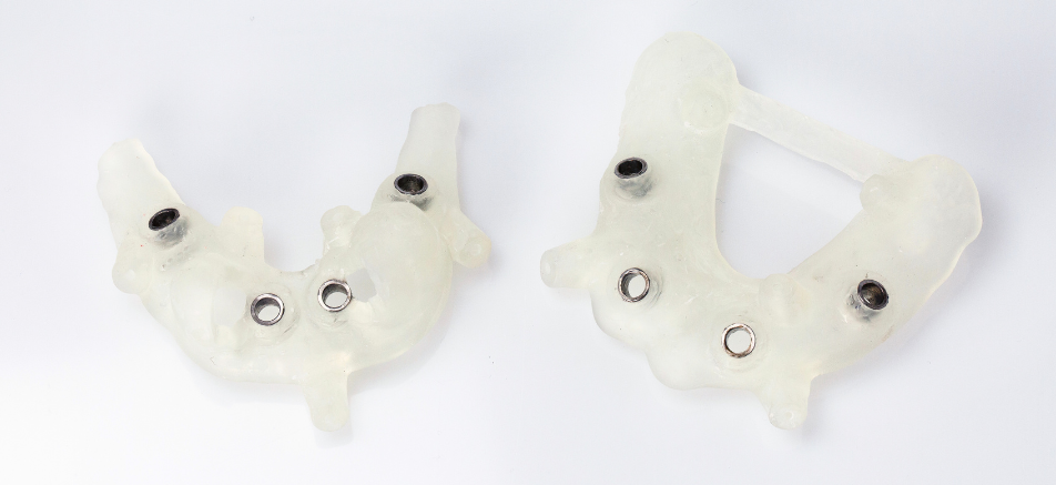 インプラント・自家歯牙移植 | 江東区亀戸の歯科、歯医者｜オーデンタルケアクリニック